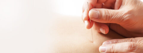 Acupuncture - RxDx Clinics