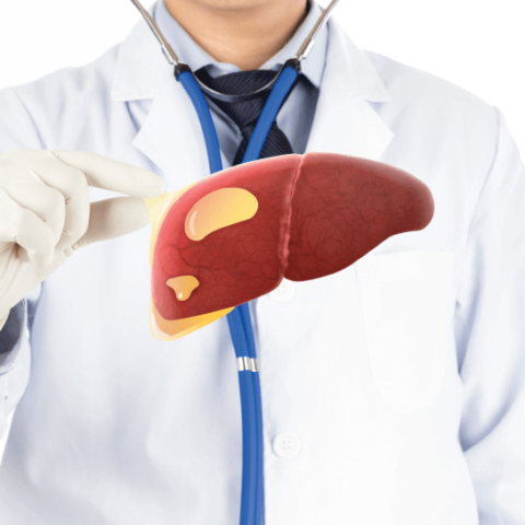 Comprehensive Fatty Liver Screening Package | RxDx: Expert NASH Screening
