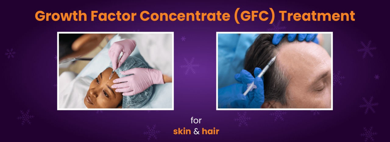 GFC treatment for hair | GFC for Skin in Bangalore | RxDx