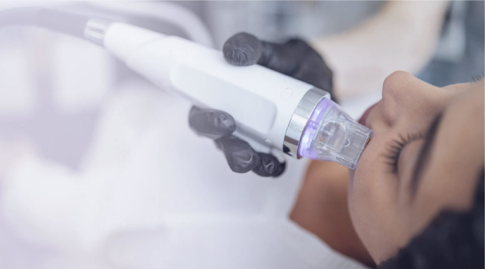 MNRF Treatment in Whitefield, Bangalore | Best Doctor for Microneedling ...